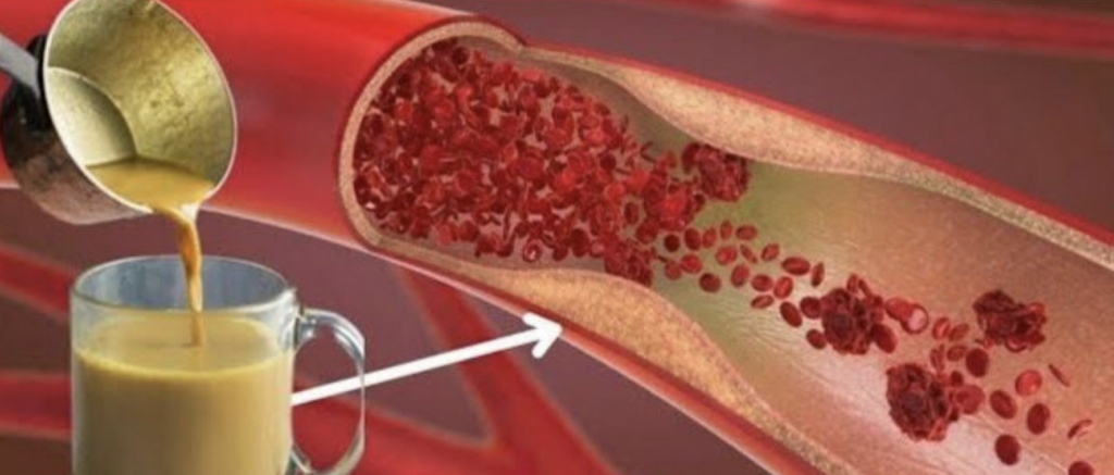 1 Cup a Day and You Will Never Get a Blood Clot: Turmeric and Ginger Drink