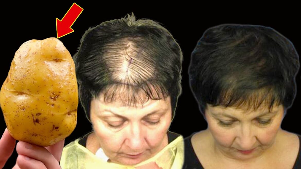 Unlock Rapid Hair Growth with This Powerful Potato Recipe!