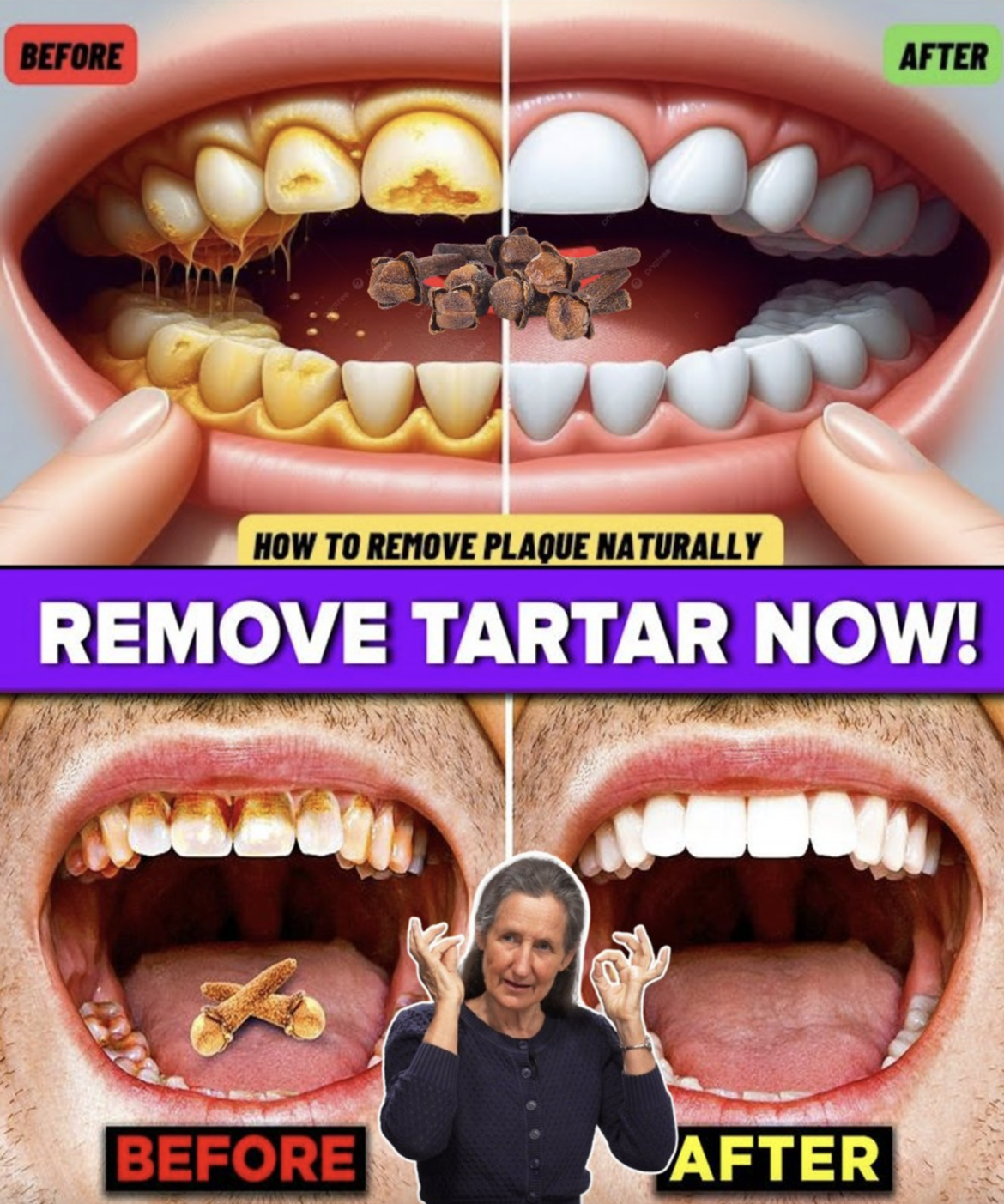 9 Natural Ways to Remove Plaque and Tartar Buildup for a Healthier Smile